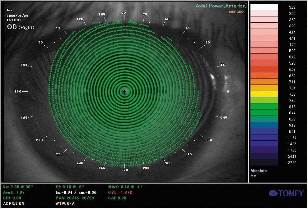 Tomey TMS-4 Corneal Topographer | Dauh Eye Care