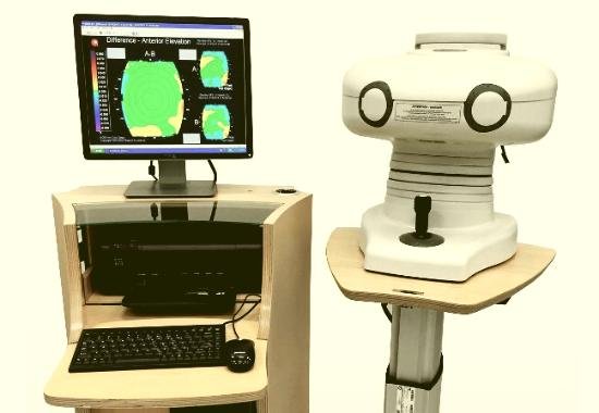 Bausch and Lomb Orbscan IIZ Topographer | Dauh Eye Care
