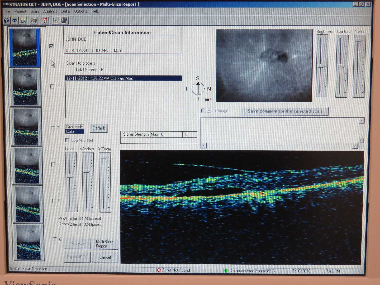 CARL ZEISS Stratus OCT III 3000 Tomography | Dauh Eye Care