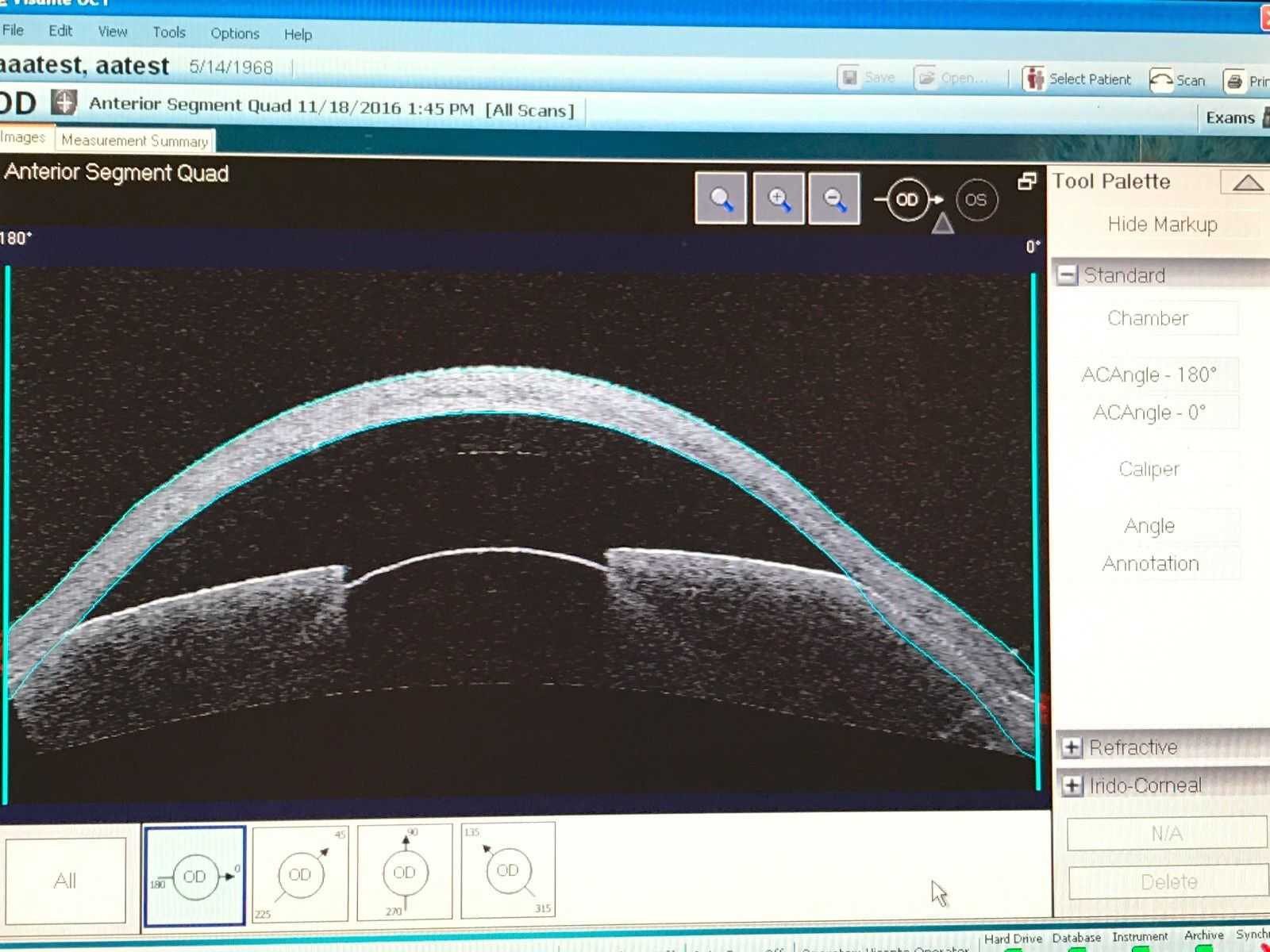 Carl Zeiss Visante OCT Anterior Segment Imaging Biometry high ...
