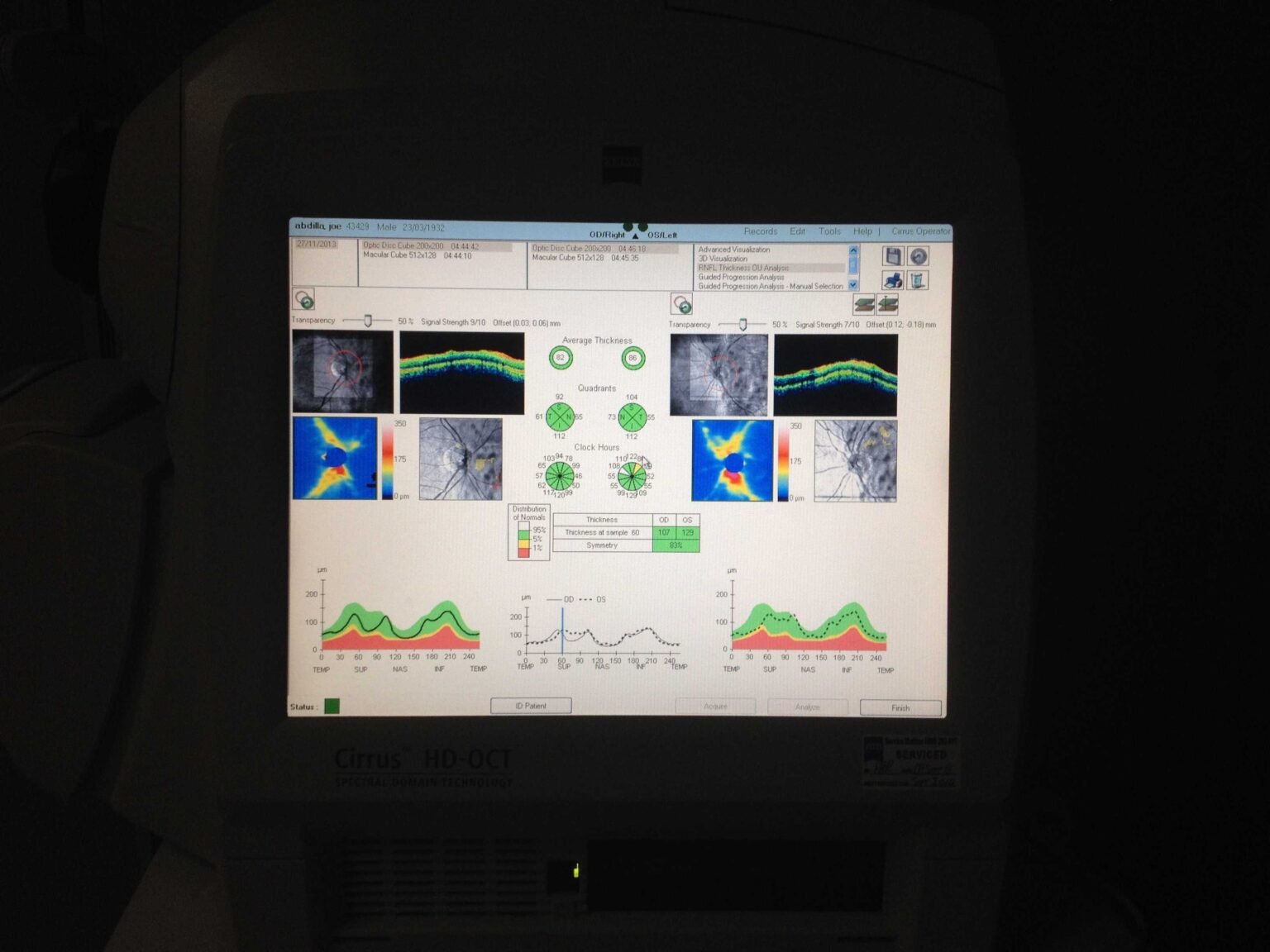Heidelberg Spectralis HRA + OCT | Dauh Eye Care