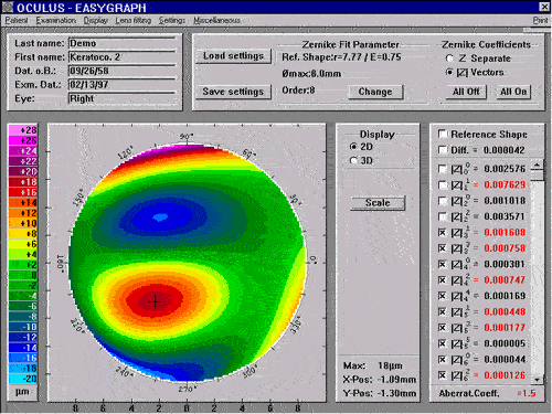 Oculus Easygraph Keratometer and Topography | Dauh Eye Care