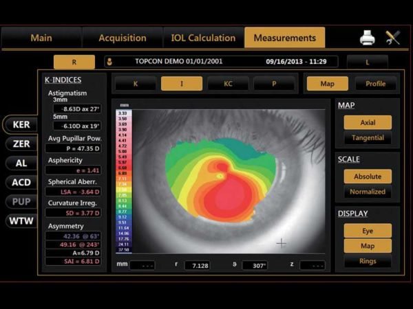 Topcon Aladdin Biometer and Corneal Topographer HW3.0 | Dauh Eye Care